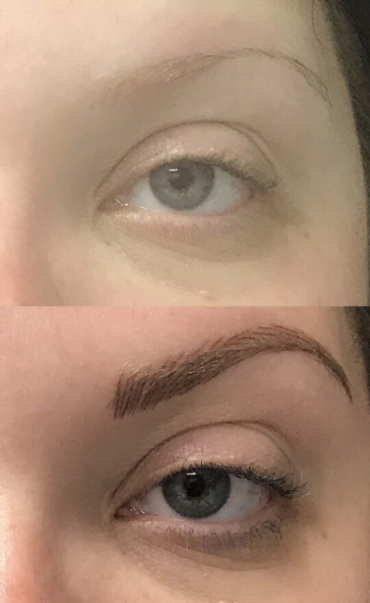 Microblading Eye Brows | Healthy Solutions Medspa®