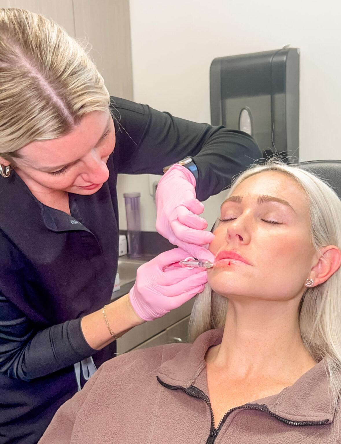 Everything You Need to Know About Mini Lip Filler Treatments